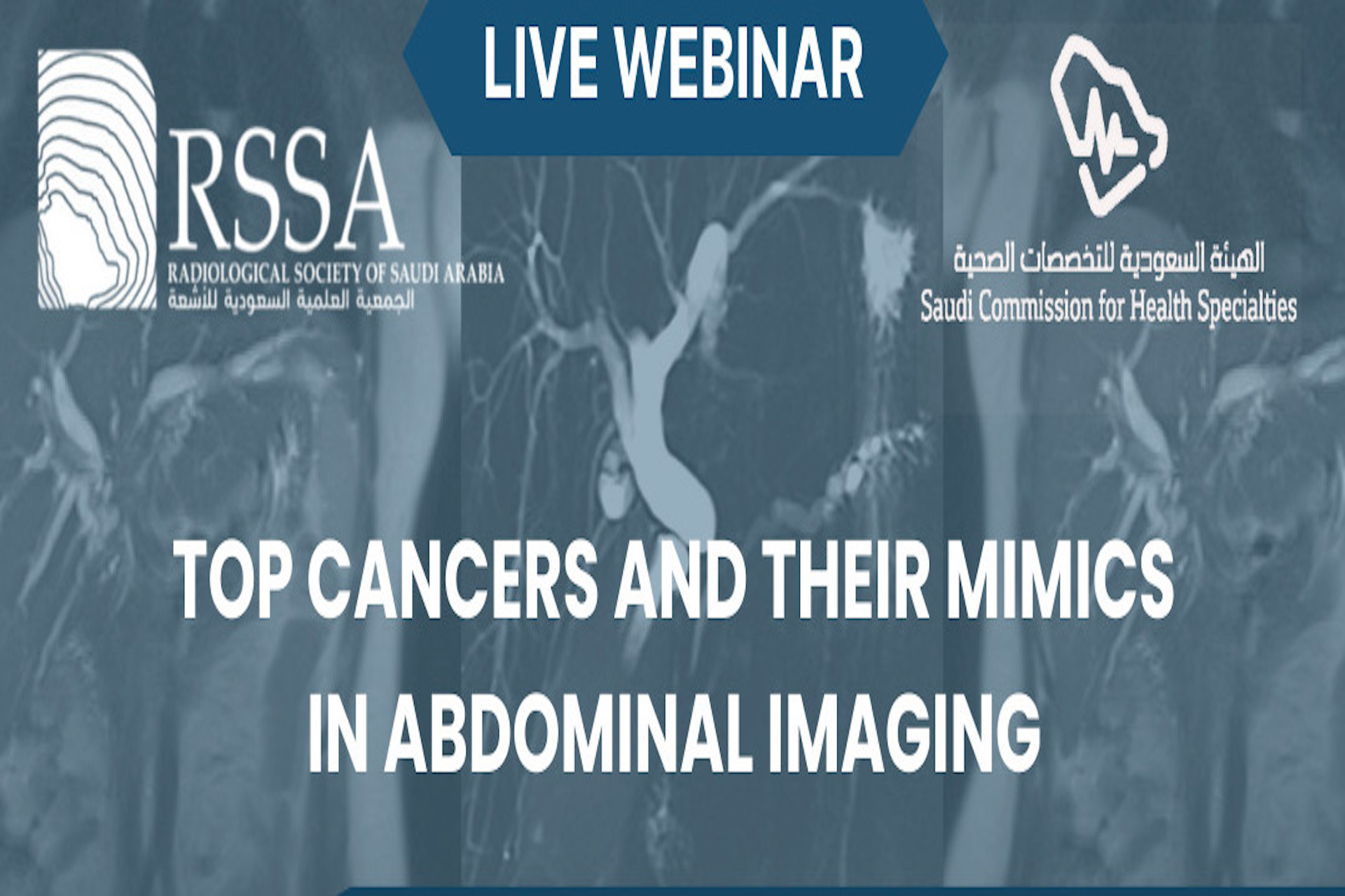 RSSA-Webinar: Top Cancers and Their Mimics in Abdominal Imaging
